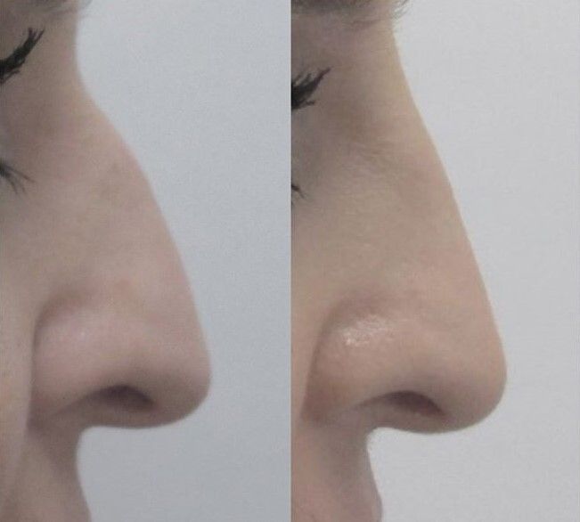 Dott. Stefano Bezzi - Guidaestetica.it